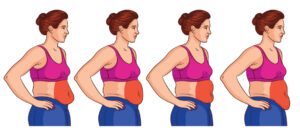 How to Get Rid of Hormonal Belly Fat Fast (Best Exercises)