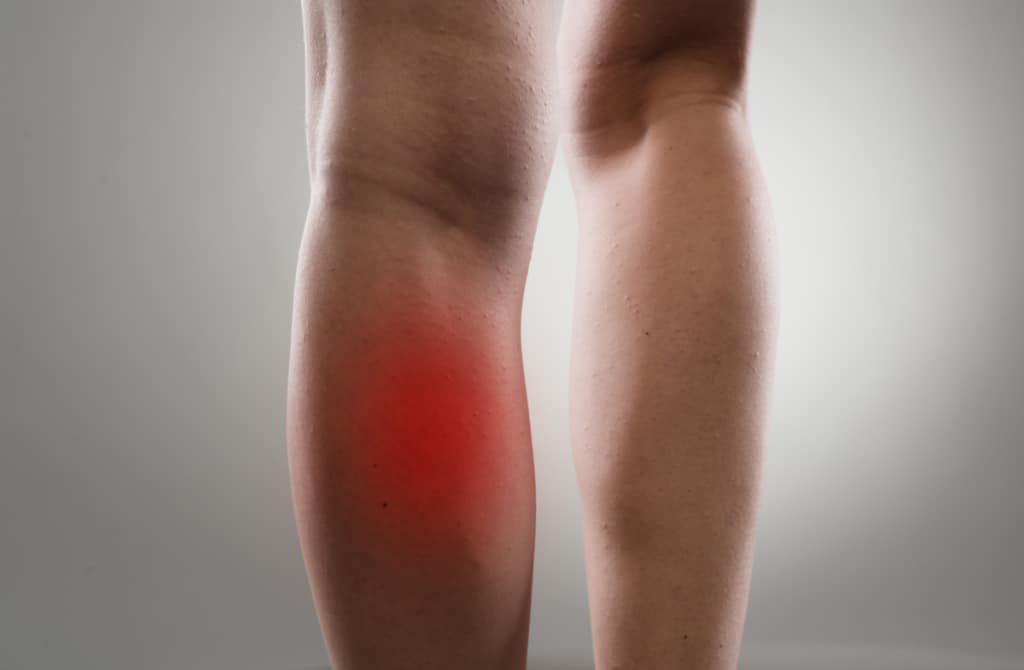 How to Get Rid of Calf Fat (Slim Down Your Calves Fast)