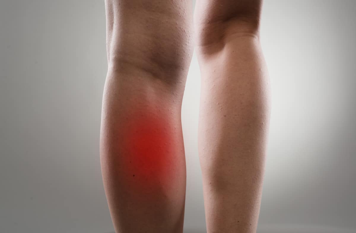 How to Get Rid of Calf Fat (Slim Down Your Calves Fast)