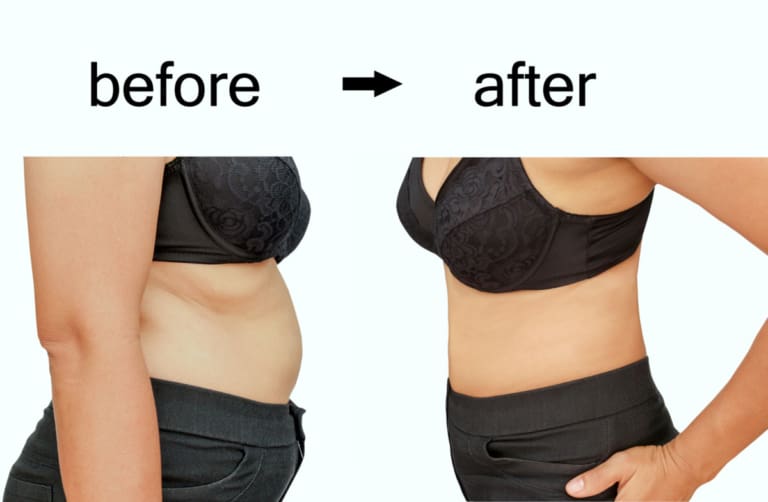 How to Get Rid Of FUPA (Naturally & Without Surgery) How to Get Rid Of FUPA (Naturally & Without Surgery)