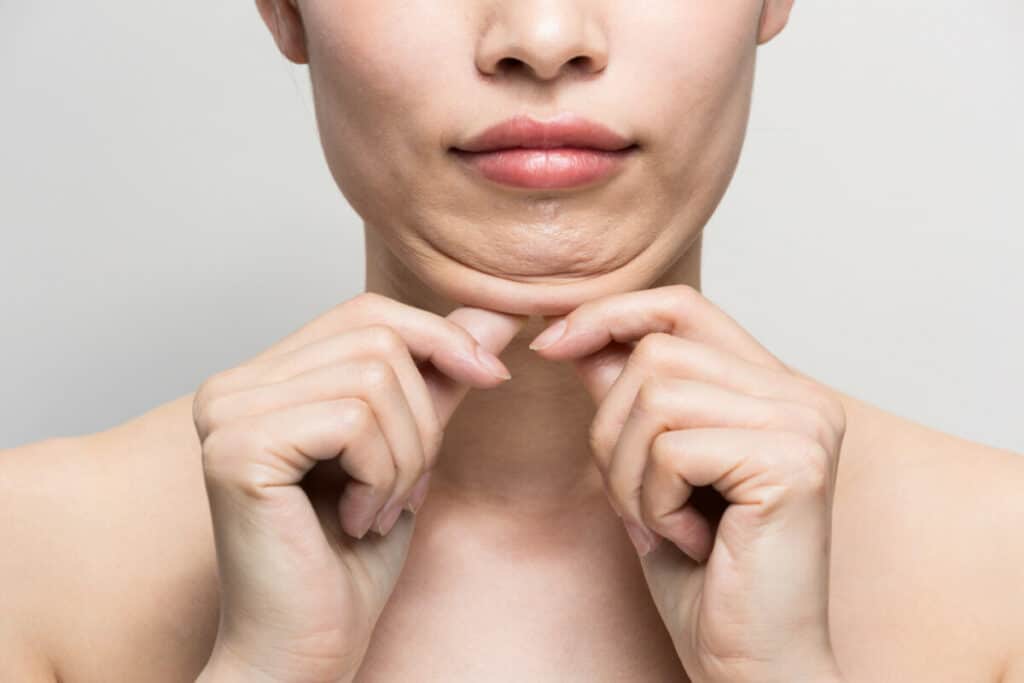 How to Get Rid of a Turkey Neck in 3 Easy Steps (No Surgery)